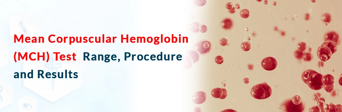 Mean Corpuscular Hemoglobin (MCH) Test: Range, Procedure and Results