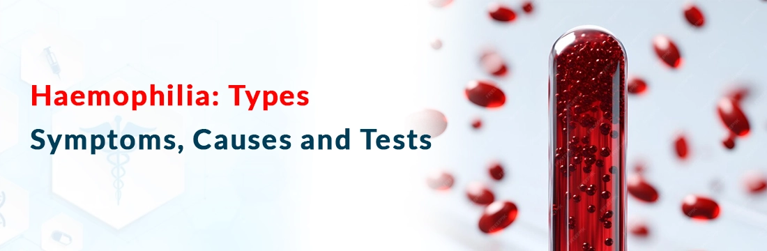 Haemophilia: Types, Symptoms, Causes and Tests