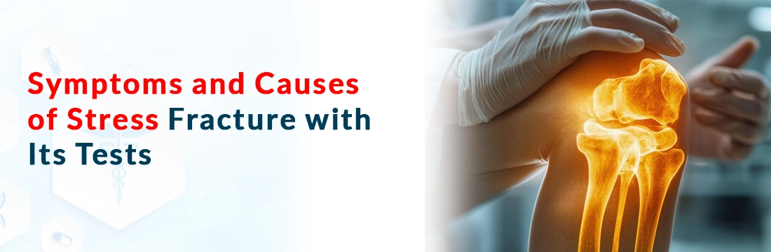 Symptoms and Causes of Stress Fracture with Its Tests
