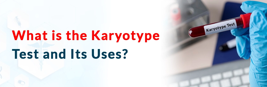 What is the Karyotype Test and Its Uses? | Ganesh Diagnostic