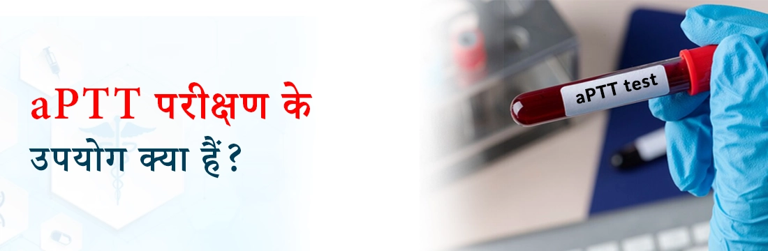 aPTT परीक्षण के उपयोग क्या हैं? (Uses of aPTT test in Hindi)