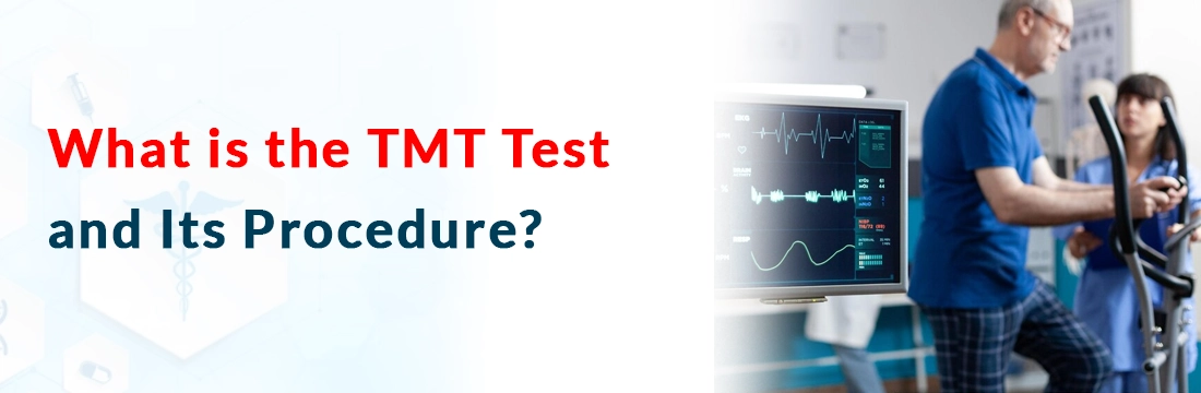 What is the TMT Test and Its Procedure? | Ganesh Diagnostic