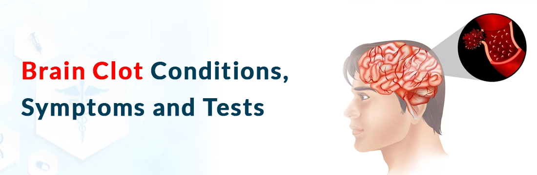 Brain Clot: Conditions, Symptoms and Tests | Ganesh Diagnostic