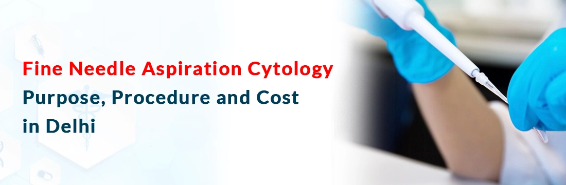 Fine Needle Aspiration Cytology: Purpose, Procedure and Cost in Delhi