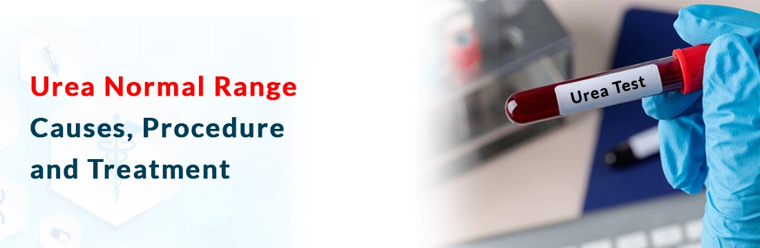 Urea Normal Range, Causes, Procedure, and Treatment