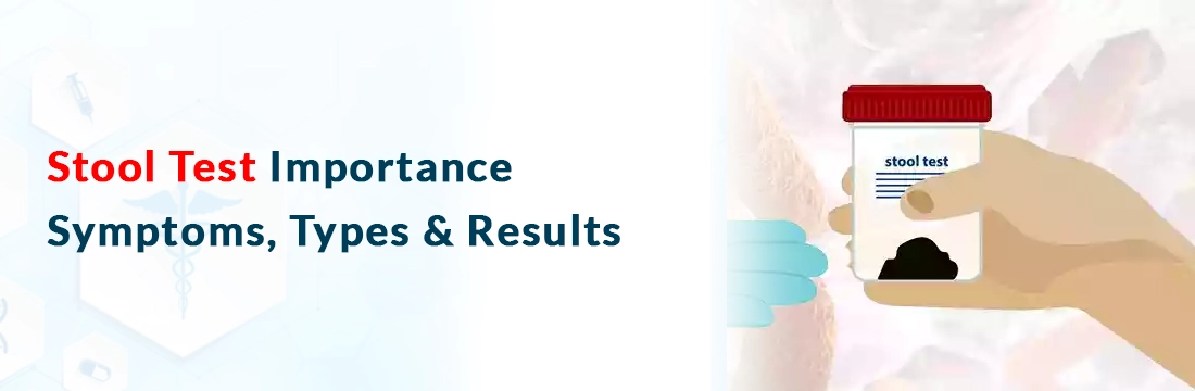 Stool Test: Importance, Symptoms, Types & Results