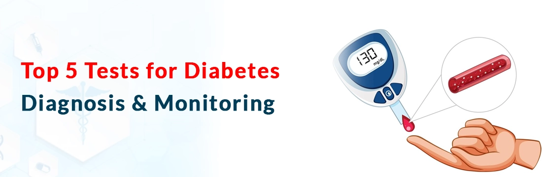 Top 5 Tests for Diabetes: Diagnosis & Monitoring | Ganesh Diagnostic