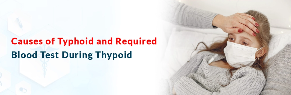 Causes of Typhoid and Required Blood Test During Thypoid