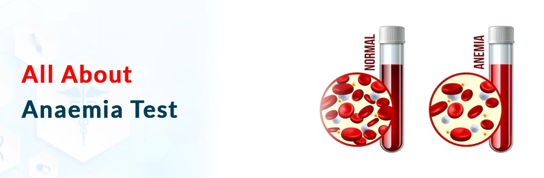 All About Anaemia Test | Ganesh Diagnostic