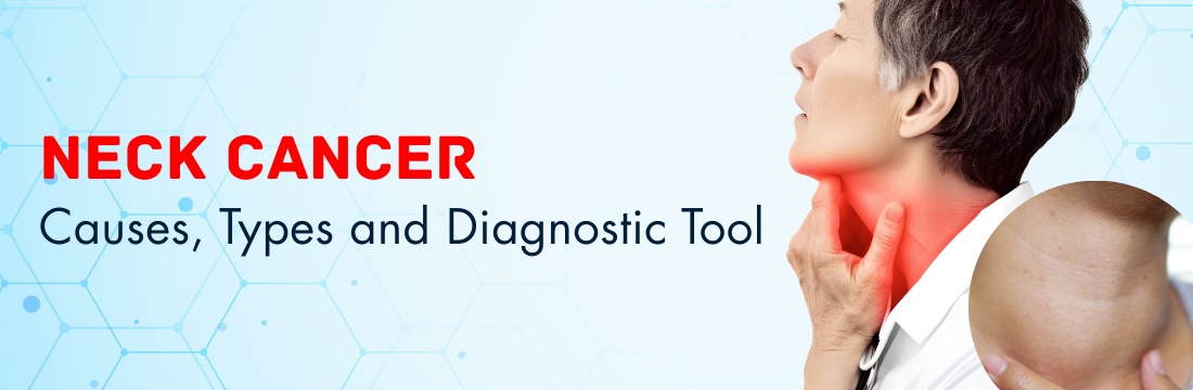 Neck Cancer: Causes, Types and PET CT as Diagnostic tool