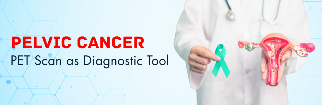 Pelvic Cancer and PET CT as Diagnostic Tool | Ganesh Diagnostic
