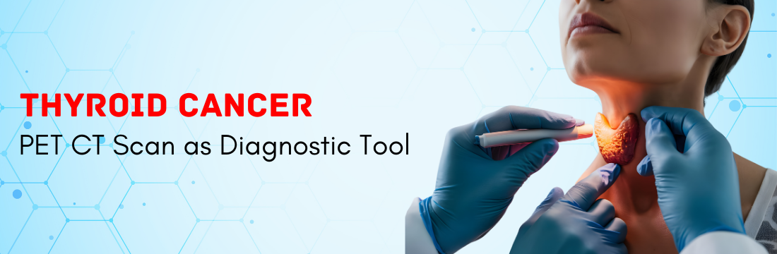 PET CT as Diagnostic Tool for Thyroid Cancer | Ganesh Diagnostic