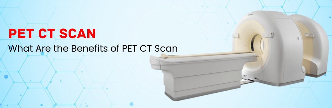 What Are theWhat Are the Benefits of PET CT Scan