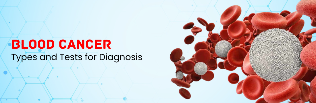 Types of Blood Cancer and Tests for Diagnosis | Ganesh Diagnostic