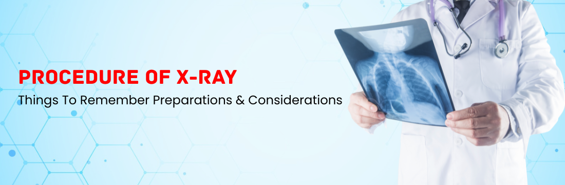 Understanding The Procedure of X-Ray: Things To Remember, Preparations ...