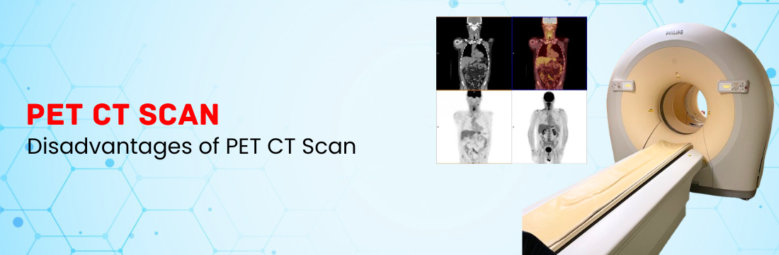 Disadvantages of PET-CT Scan | Ganesh Diagnostic