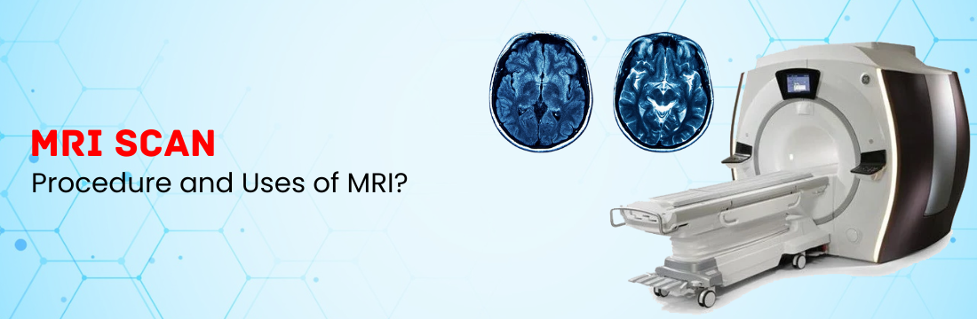 What are the Procedure and Uses of MRI? | Ganesh Diagnostic