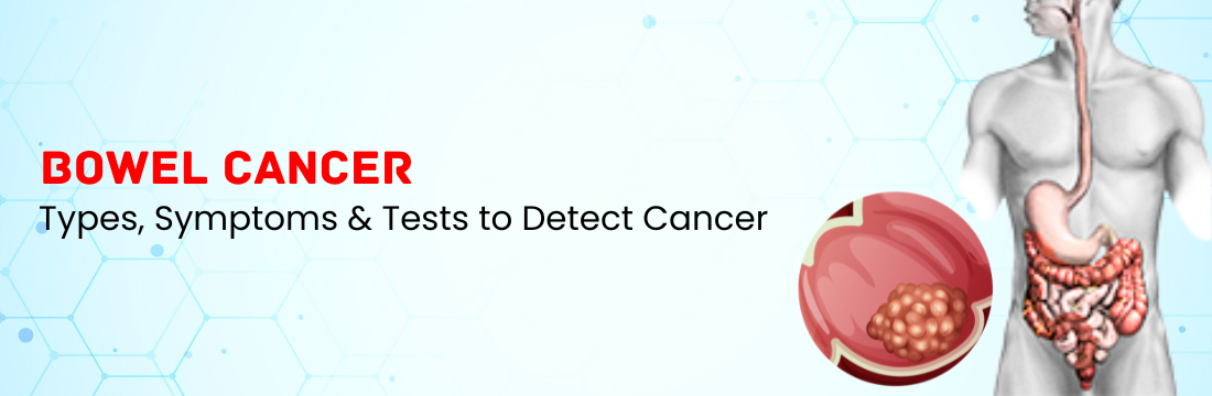 Which Tests Are Used to Detect Bowel Cancer | Ganesh Diagnostic