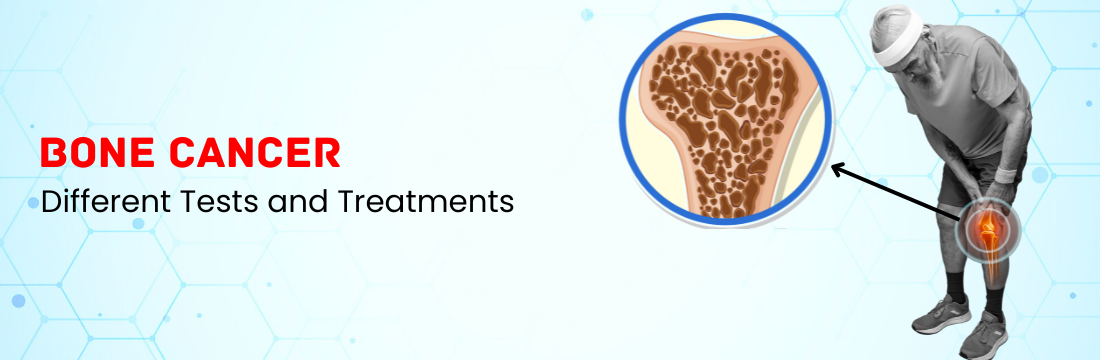 Different Tests and Treatments for Bone Cancer | Ganesh Diagnostic