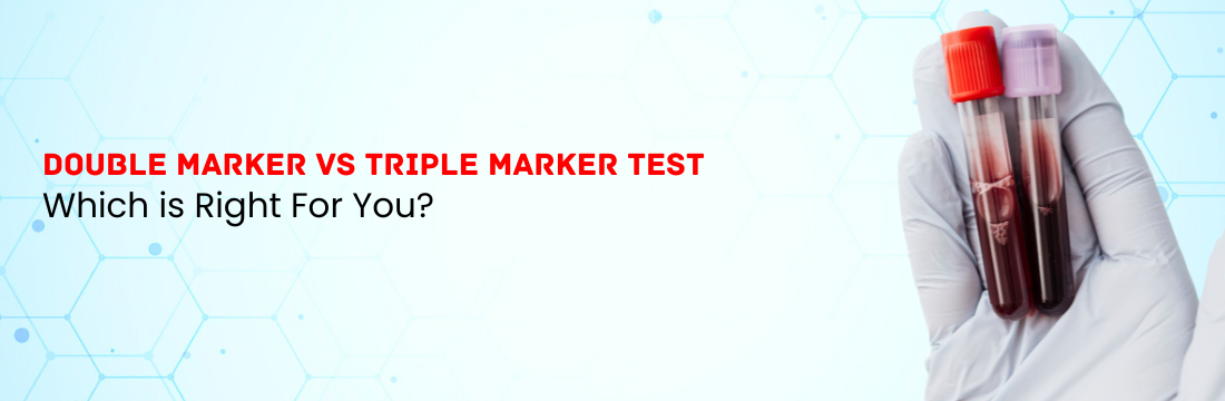 Double Marker Vs Triple Marker Test: Which Is Right For You? | Ganesh ...