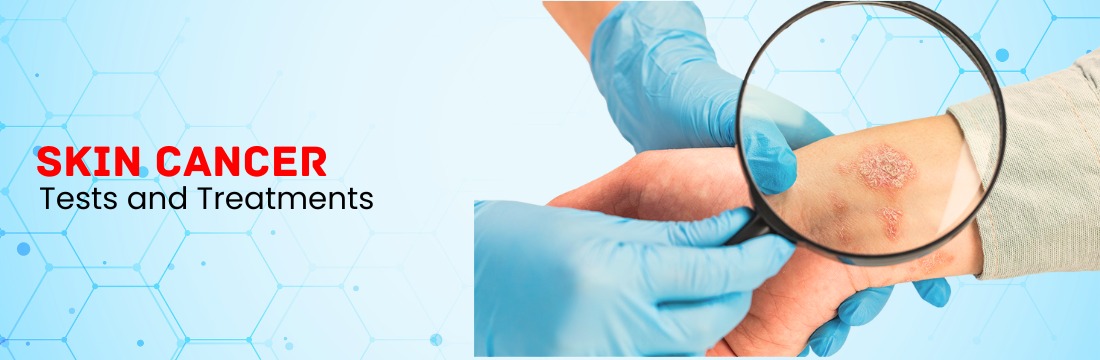 Tests and Treatments for Skin Cancer | Ganesh Diagnostic