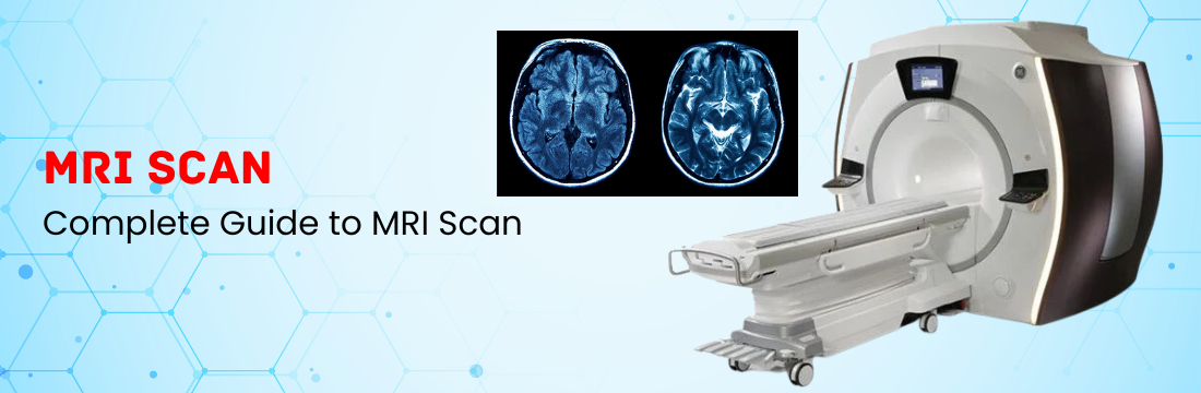 A Complete Guide to MRI Scan (Magnetic Resonance Imaging)