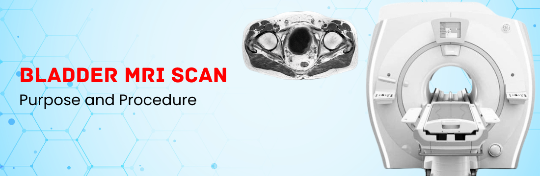 Bladder MRI: Purpose and Procedure | Ganesh Diagnostic