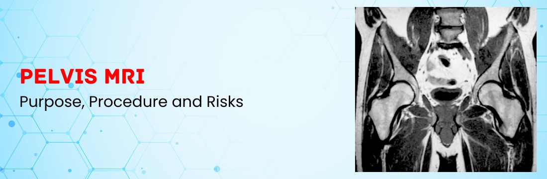 Pelvis MRI: Purpose, Procedure and Risks | Ganesh Diagnostic