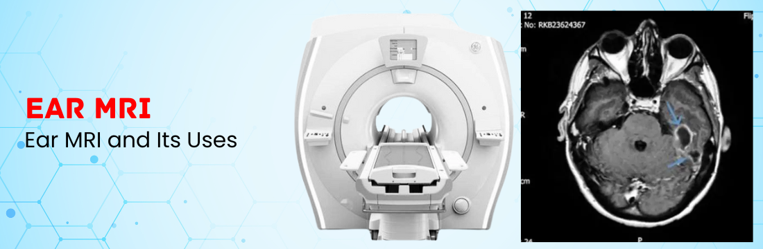 Ear MRI and Its Uses | Ganesh Diagnostic