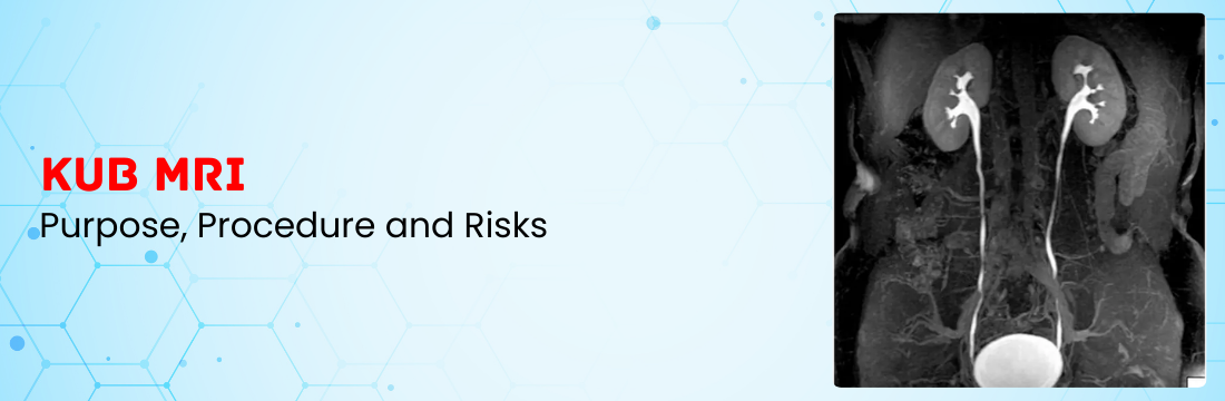 Full Body MRI Screening: When to go and what it shows | Ganesh Diagnostics