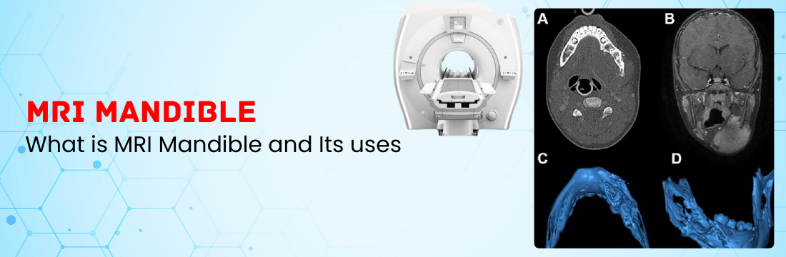 MRI Mandible: Its uses | Ganesh Diagnostic