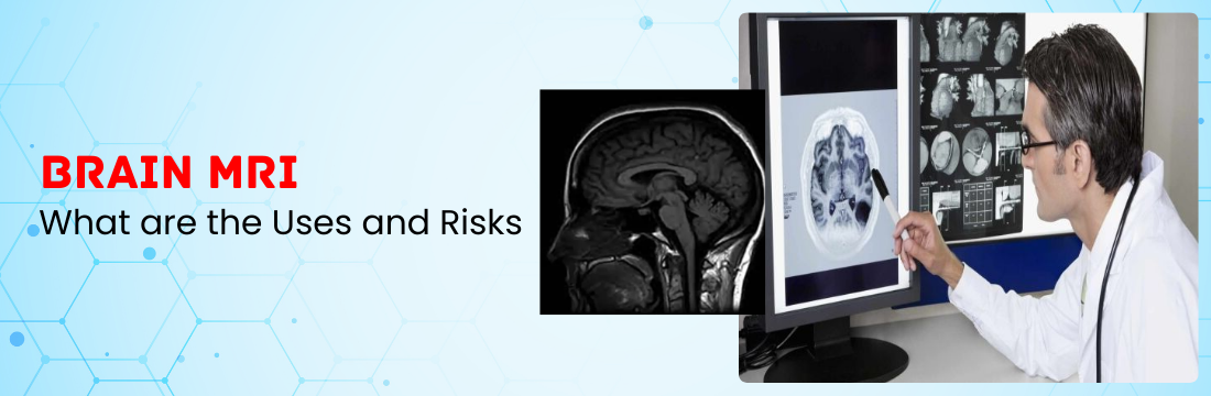 Uses and Risks of Brain MRI | Ganesh Diagnostic