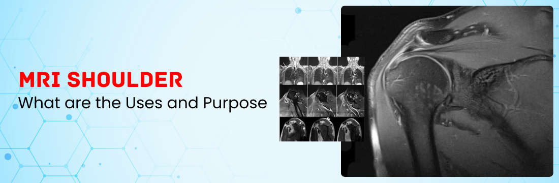 What is MRI Shoulder: Its Uses | Ganesh Diagnostic