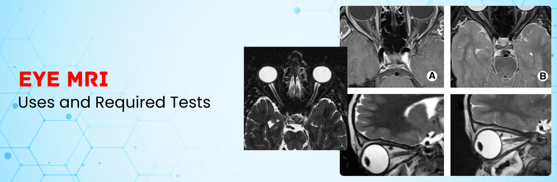 Uses of Eye MRI | Ganesh Diagnostic