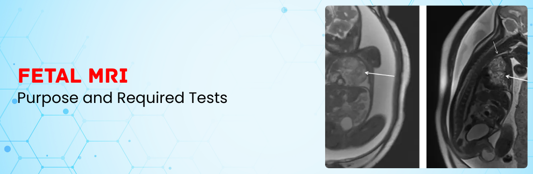 What are the Purpose of Fetal MRI | Ganesh Diagnostic