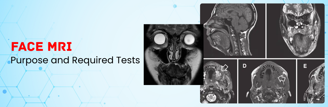 What are the Purpose of Face MRI | Ganesh Diagnostic