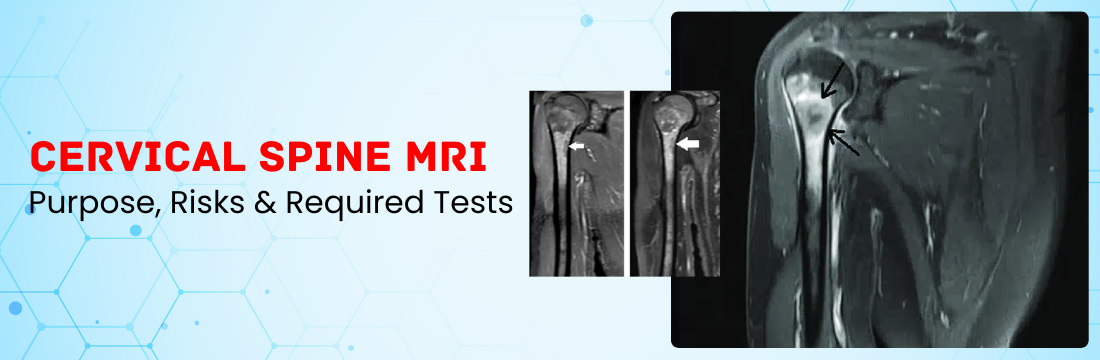 Cervical Spine MRI: Purpose, Procedure and Risks | Ganesh Diagnostic