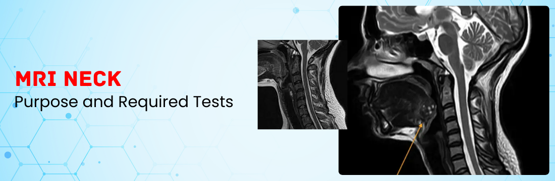 What are the Uses of MRI Neck | Ganesh Diagnostic