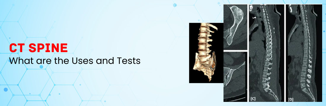 CT Spine: What Are the Uses | Ganesh Diagnostic