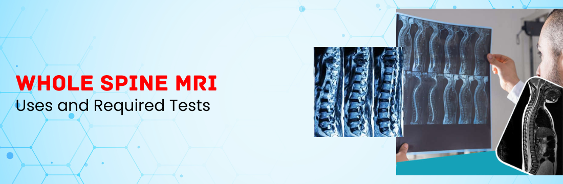 Whole Spine MRI and Its Uses | Ganesh Diagnostic
