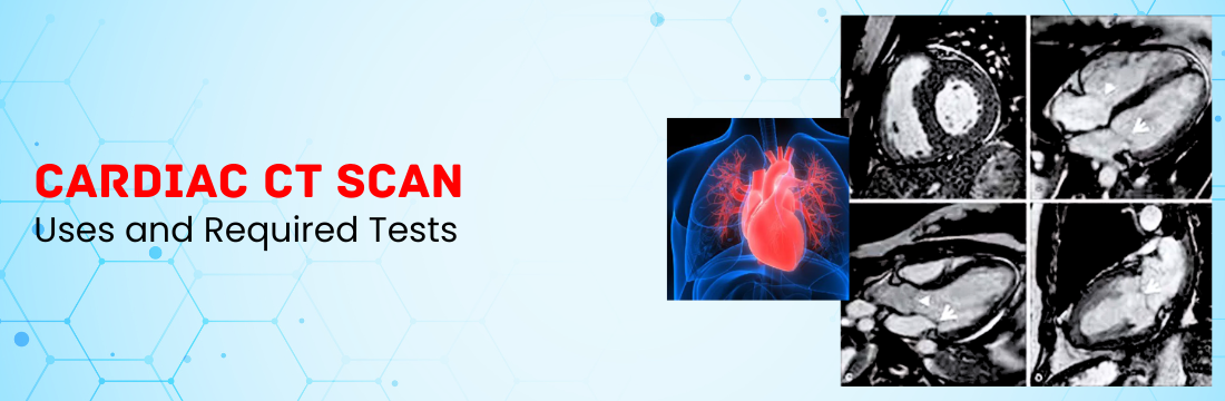 Cardiac CT Scan and Its Uses | Ganesh Diagnostic