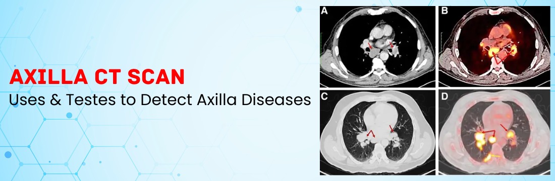 Axilla CT Scan and Its Uses | Ganesh Diagnostic