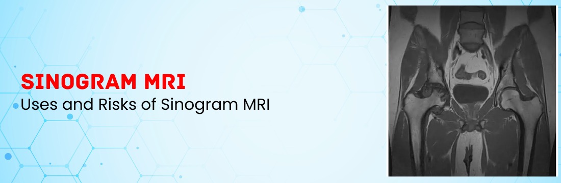Sinogram MRI: Uses and Risks | Ganesh Diagnostic