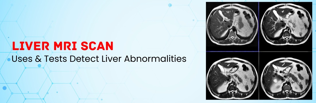 Liver MRI Scan and Its Uses | Ganesh Diagnostic
