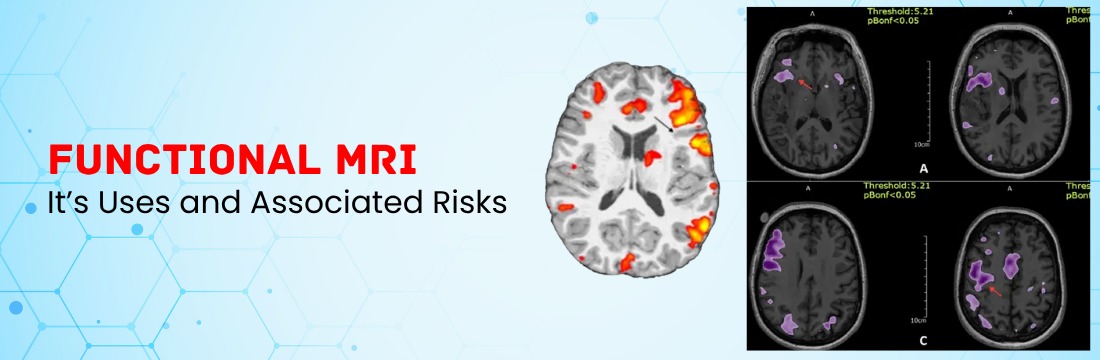 Functional MRI: Uses and Risks | Ganesh Diagnostic