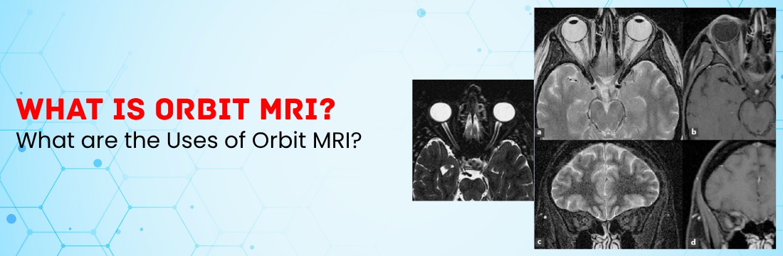 Know About Orbit MRI and Its Uses | Ganesh Diagnostic