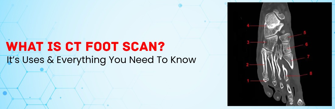 Know About CT Foot Scan and Its Uses | Ganesh Diagnostic