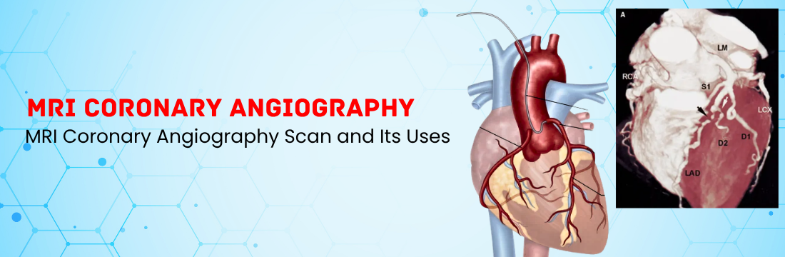 MRI Coronary Angiography Scan and Its Uses | Ganesh Diagnostic