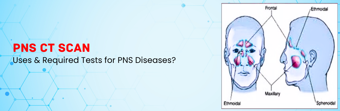 PNS CT Scan and Its Uses | Ganesh Diagnostic