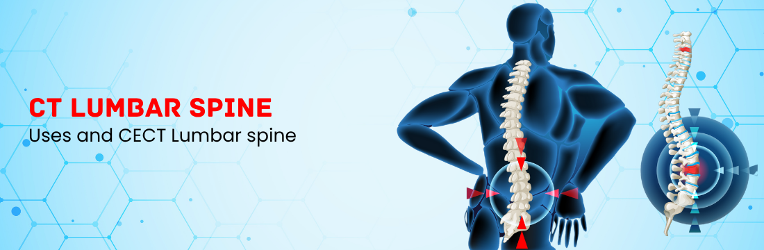 CT Lumbar Spine: What Are the Uses | Ganesh Diagnostic